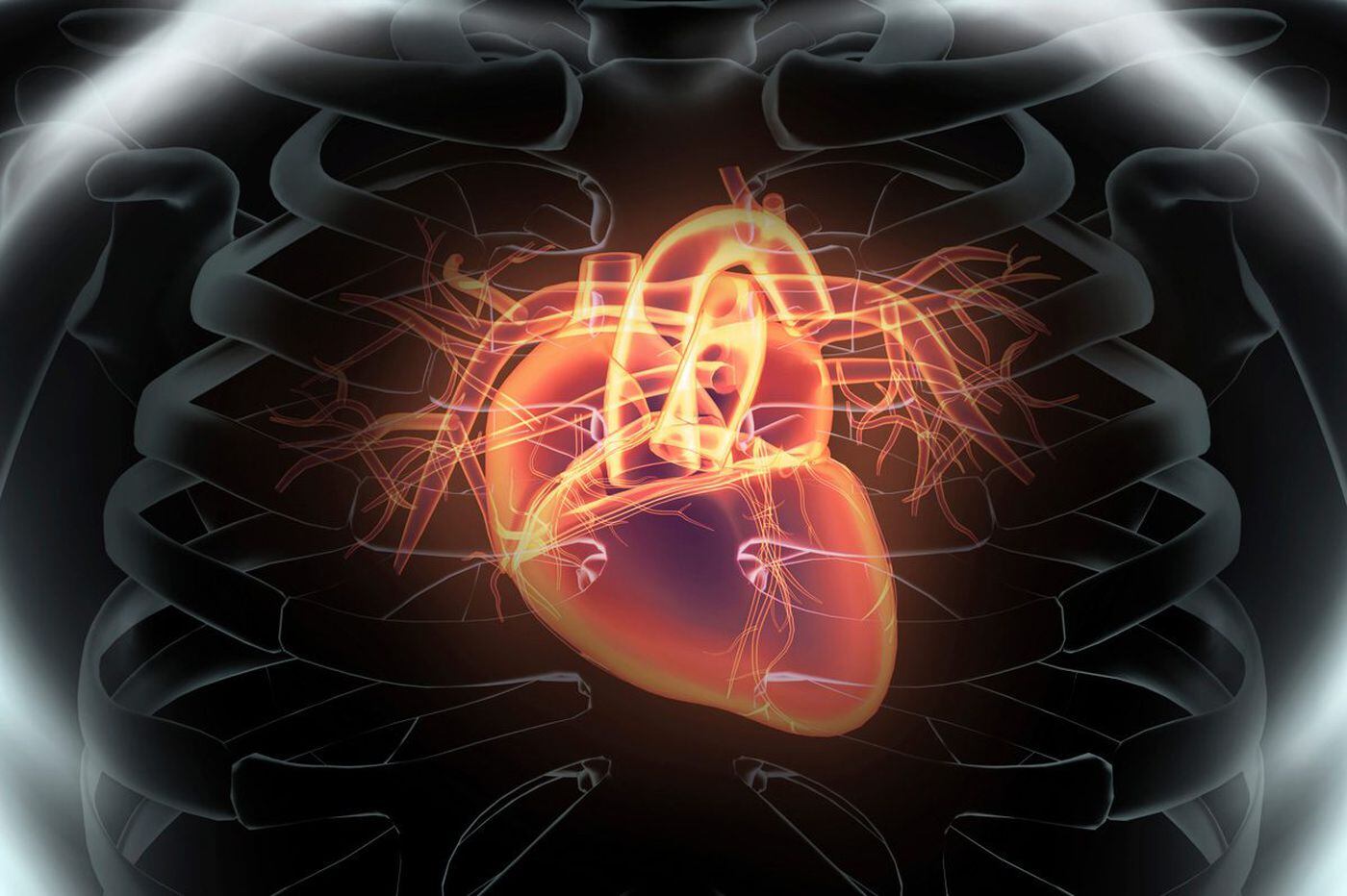 Q&A: What is cardiogenic shock, and why should I care?