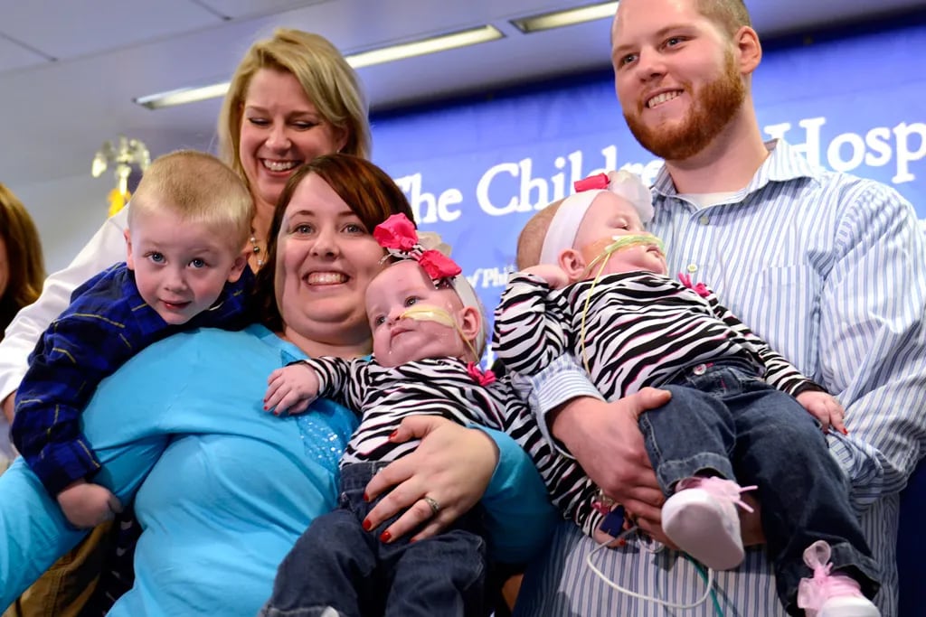 Conjoined Quadruplets