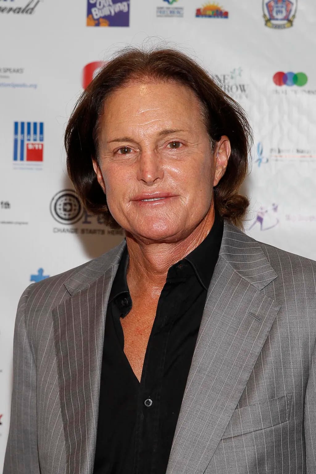 Bruce Jenner Adams Apple Before And After