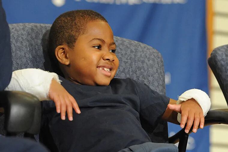 World's first pediatric double-hand transplant performed in Phila.