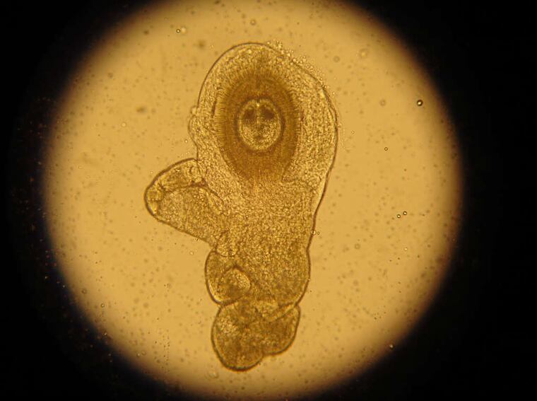 Hymenolepis Diminuta Cysticercoid CDC DPDx Hymenolepiasis