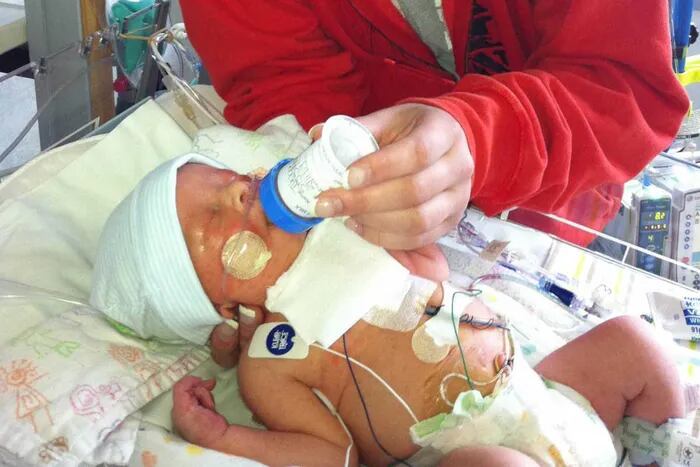 In world first, Philly surgeons remove fetal heart tumor during pregnancy